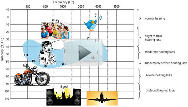 Understanding an Audiogram - Hearing Aids Australia Understanding an Audiogram - Hearing Aids Australia